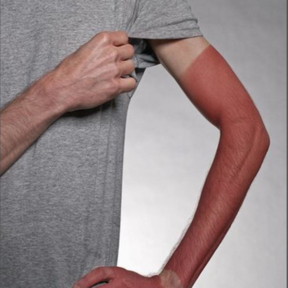 Arm Rocker Sun Blocker