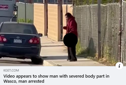 Video appears to show man with severed body part in Wasco, man arrested ...